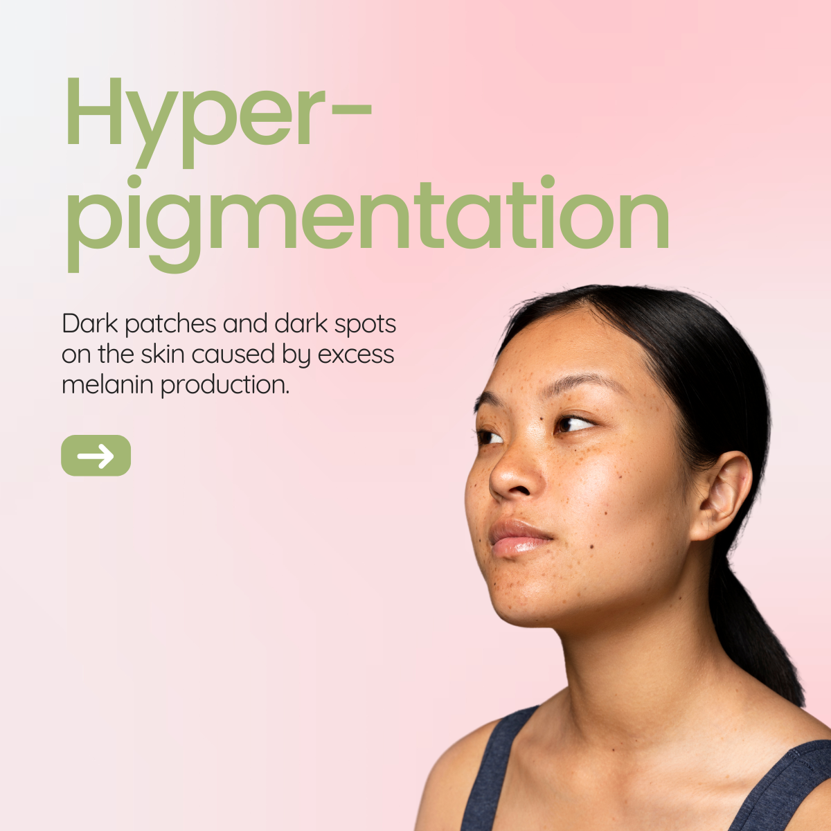 Hyper-pigmentation – Possum