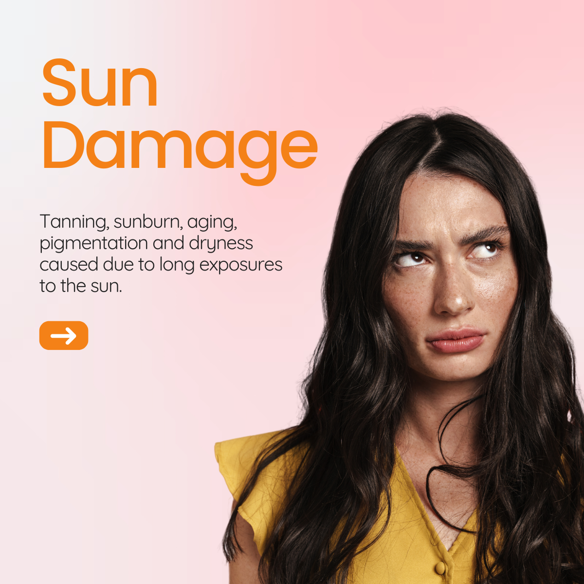 Sun Damage – Possum
