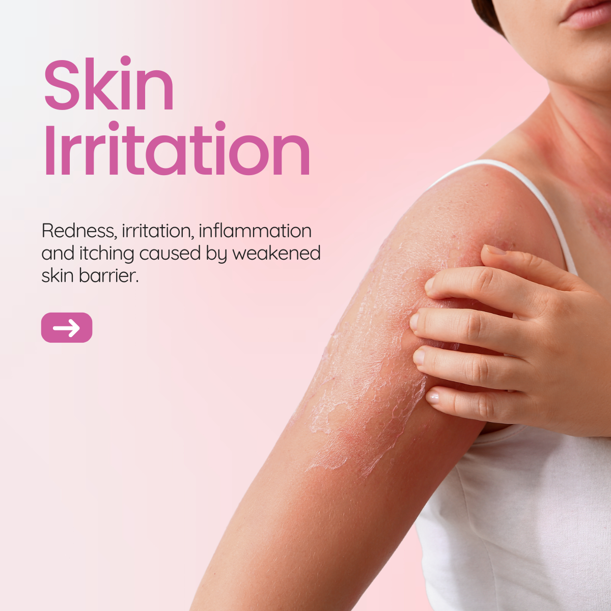 Skin Irritation – Possum